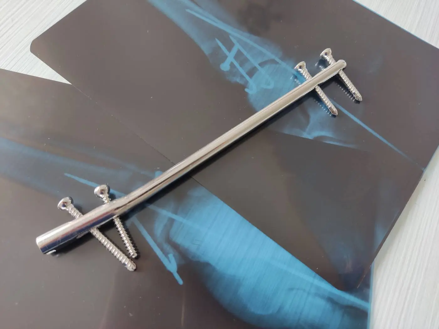 Medical Intramedullary IM Nails Inspection & Measurement